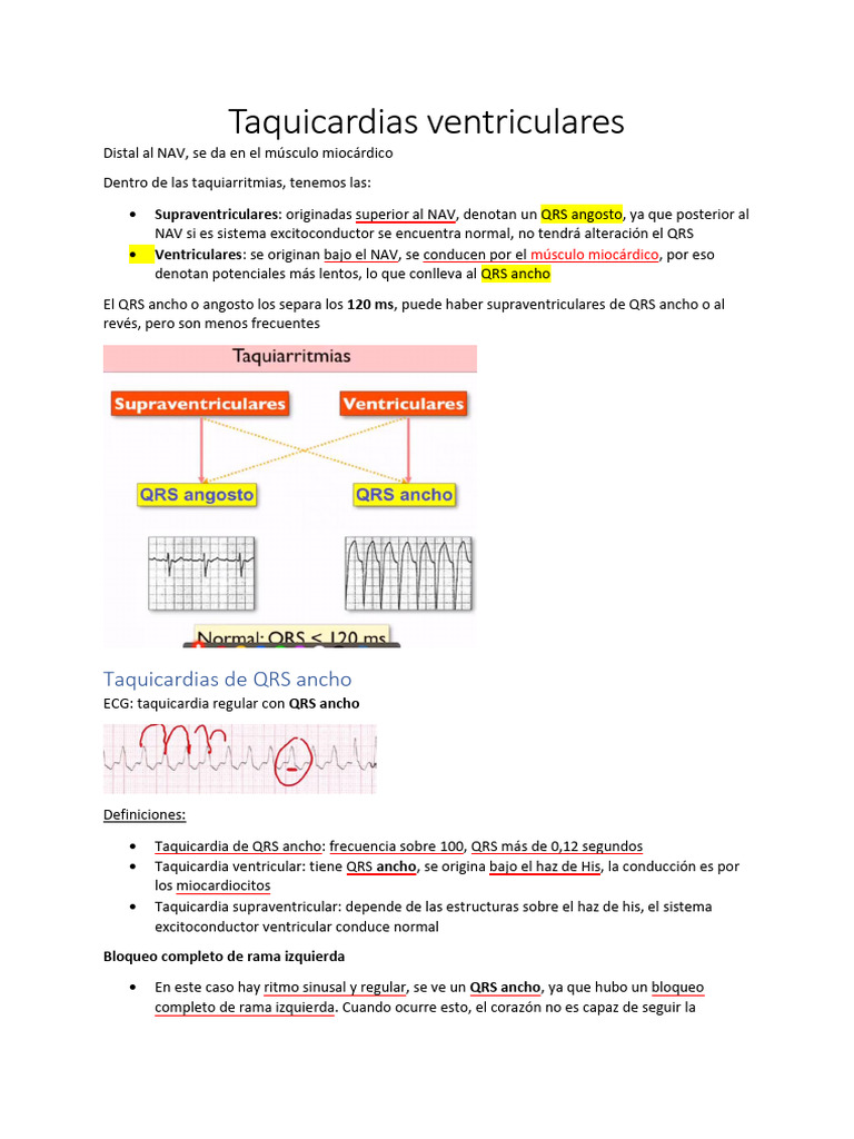 Taquicardias Ventriculares y QRS Ancho | PDF | Paro cardíaco ...