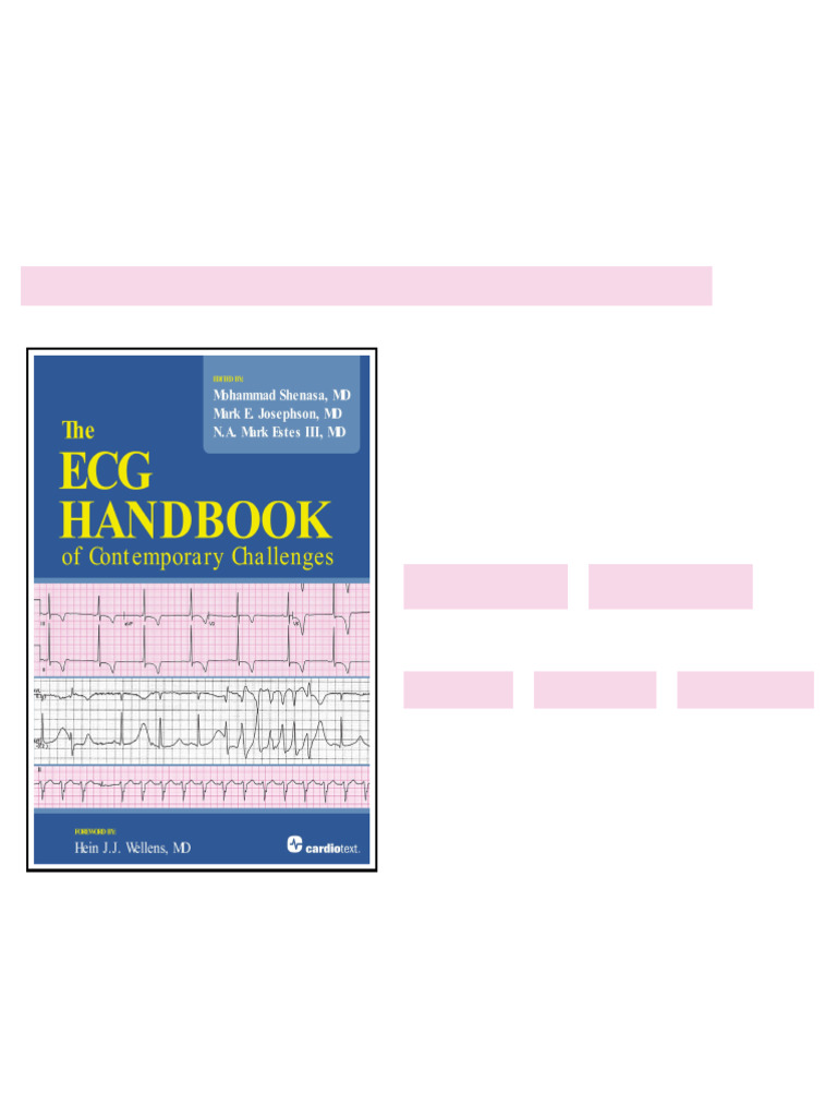 ECG Handbook of Contemporary Challenges The Wei Zhi online reading | PDF