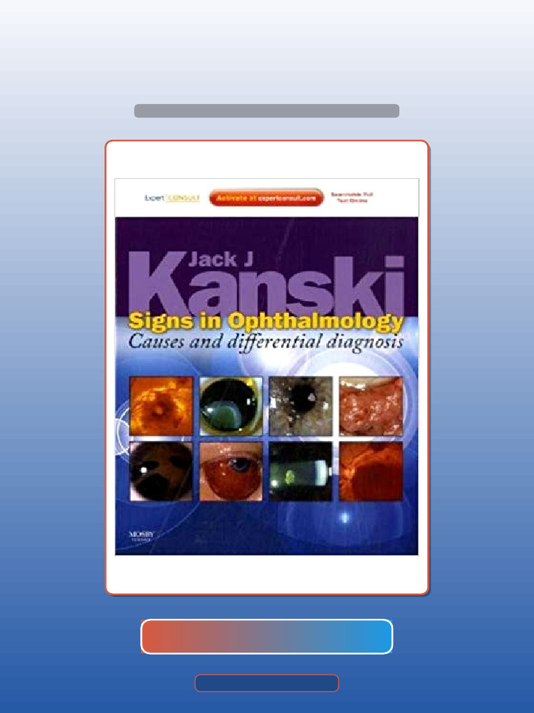 Test Bank for Signs in Ophthalmology Causes and Differential Diagnosis ...
