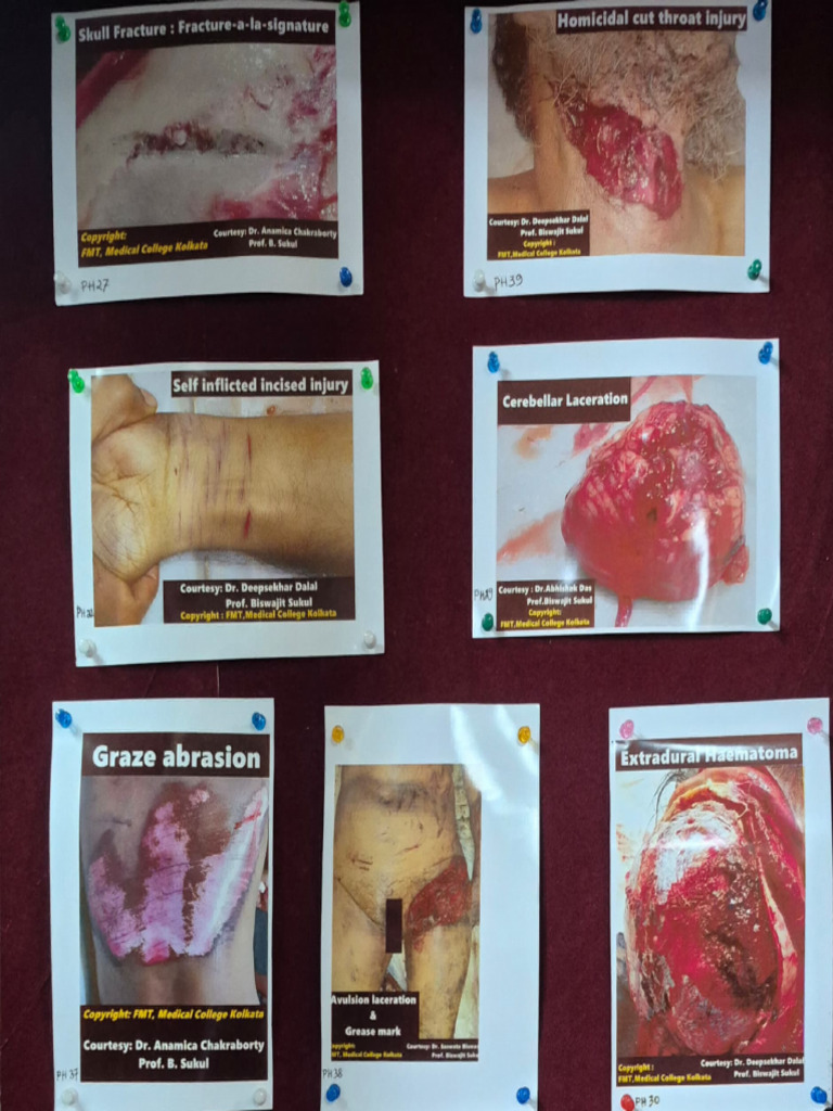 FMT photographs | PDF