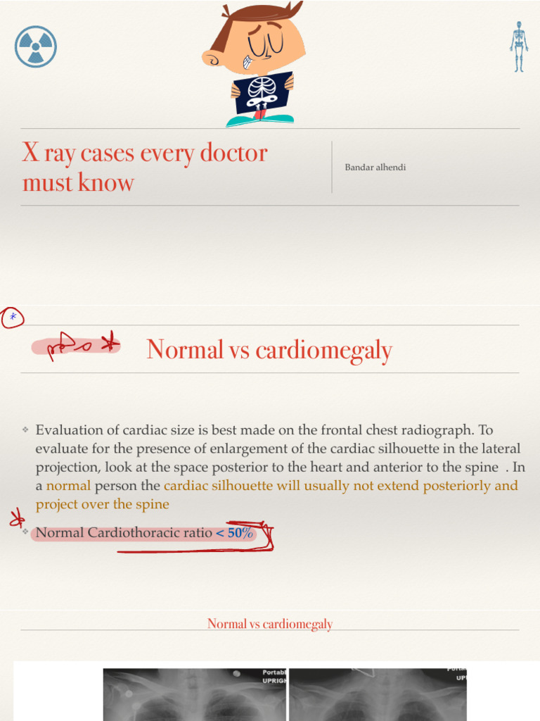 X Ray Cases Every Doctor Must Know-1 | PDF | Vertebra | Gastroenterology