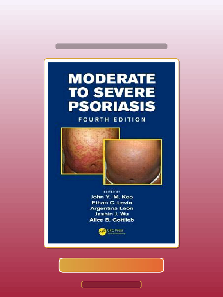 Test Bank for Moderate to Severe Psoriasis Fourth Edition | PDF