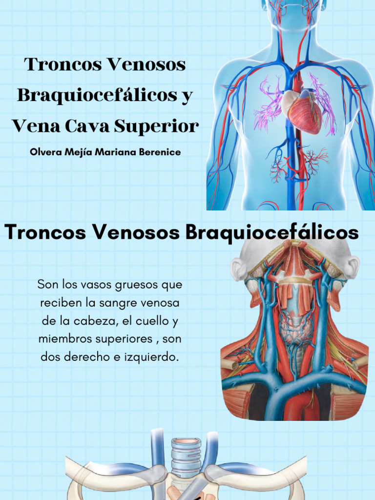 Troncos venosos braquiocefálicos y Vena cava superior | PDF | Vena ...