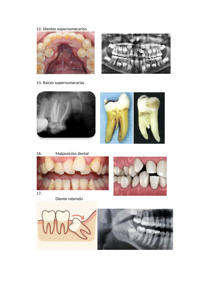 Casos de Radiografias | PDF