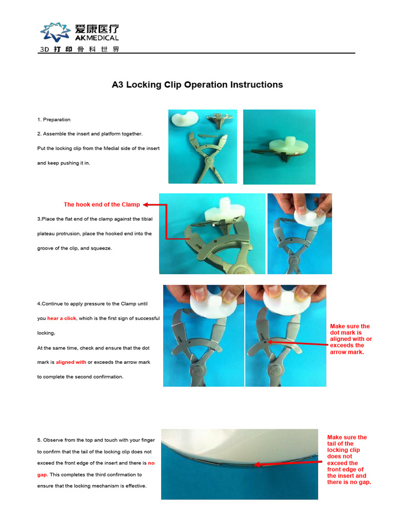 A3 TKA Surgical Technique-Locking Clip Operation | PDF