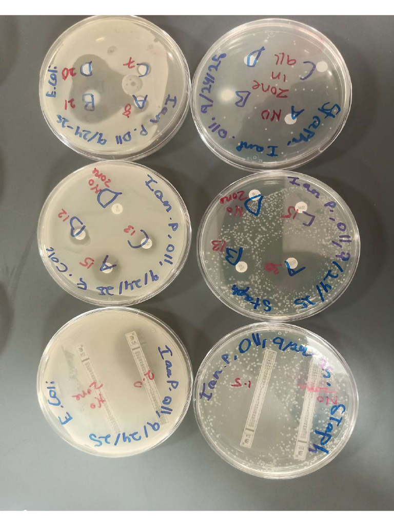 011 Plates Picture Antibiotic Disc Diffusion Selective Picture 1-Merged ...
