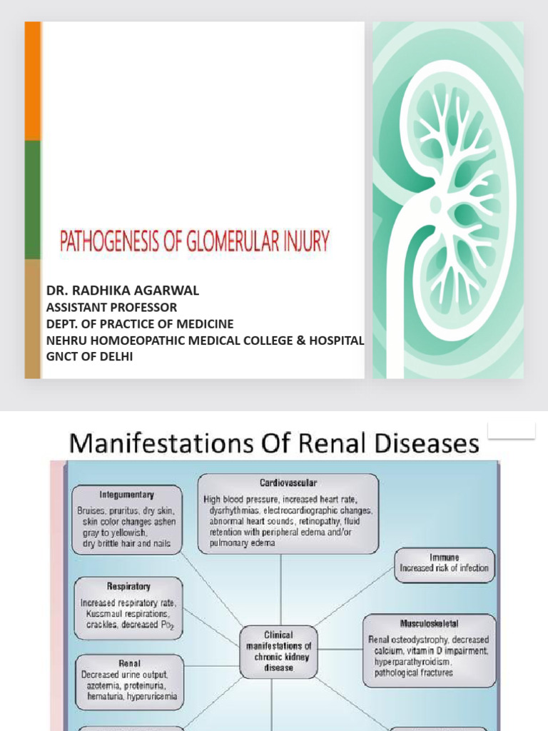 Glomerular Dis 3rd Bhms 2025 | PDF