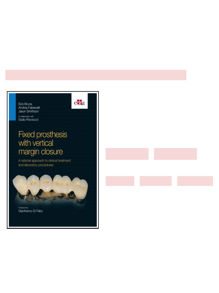 Fixed prosthesis with vertical margin closure Full Access | PDF