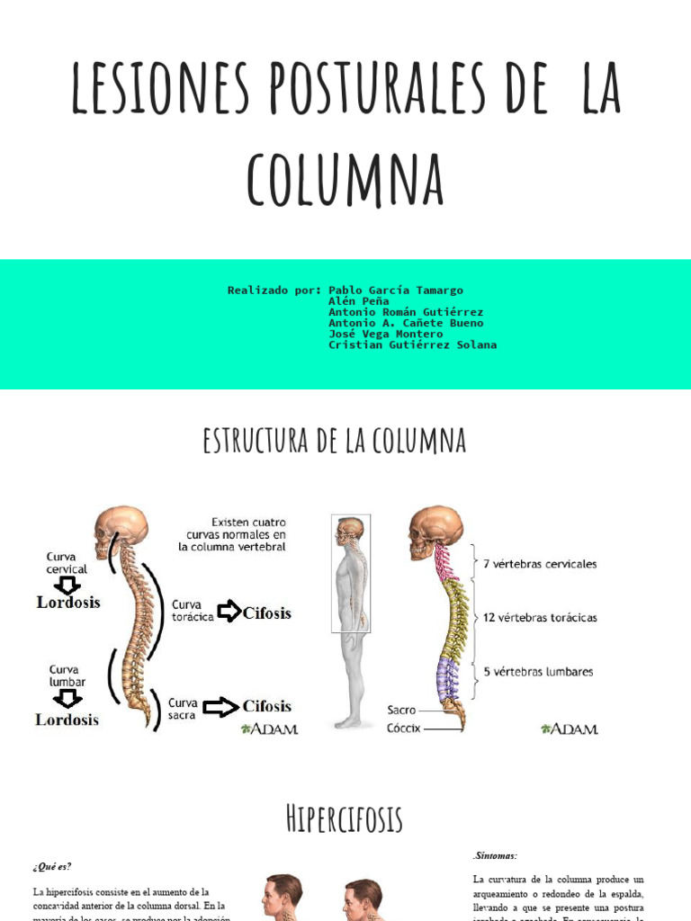 Lesiones Posturales de la Columna | PDF | Escoliosis | Enfermedades y ...