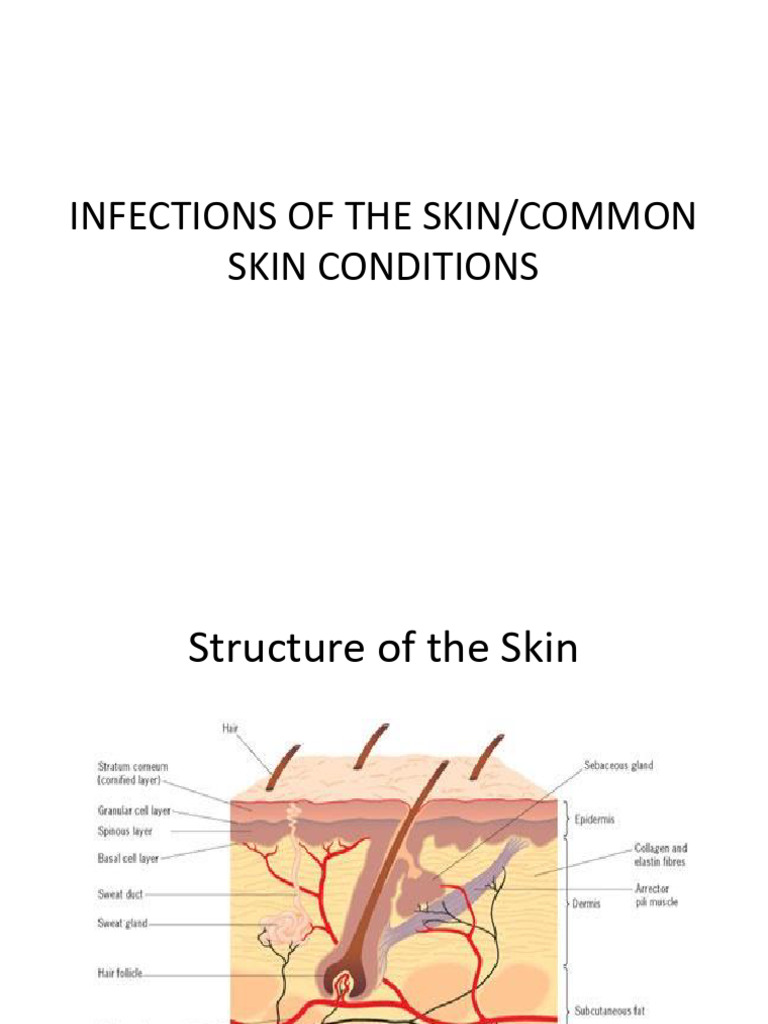 INFECTIONS OF THE SKIN COMMON SKIN CONDITIONS | PDF | Candidiasis ...