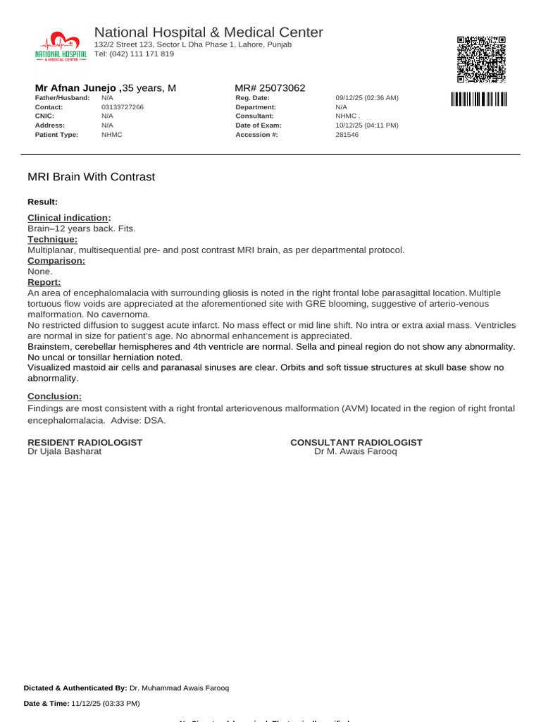 MRI Brain Report: AVM Findings | PDF