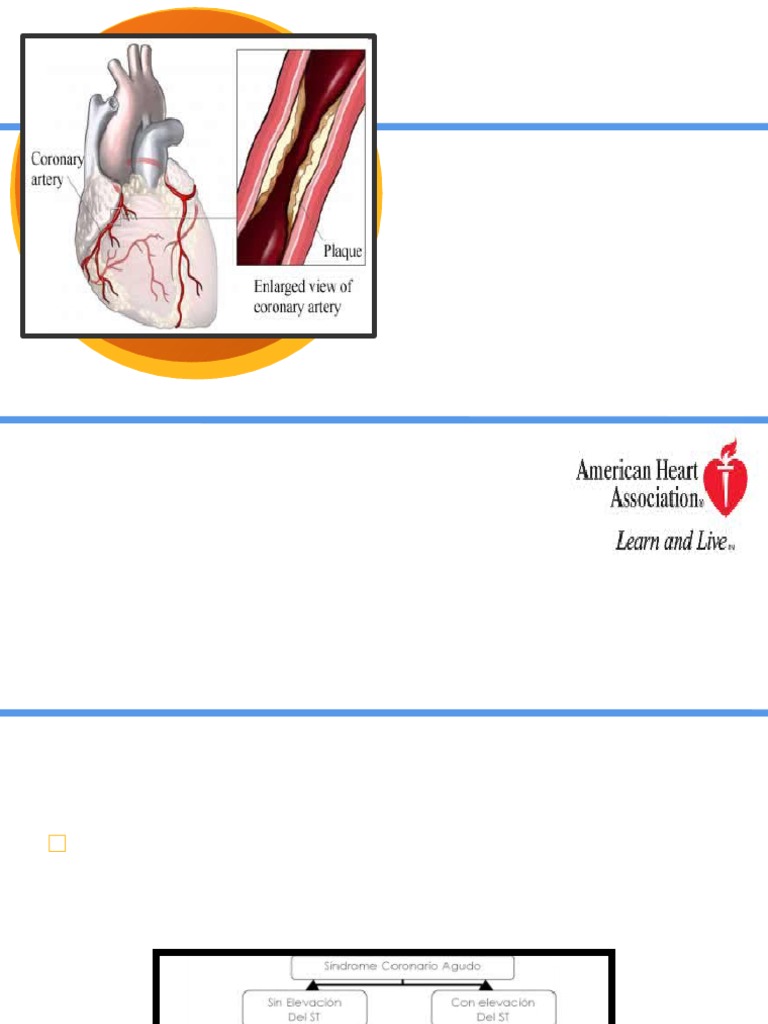 Sca | PDF | Infarto de miocardio | Angina de pecho