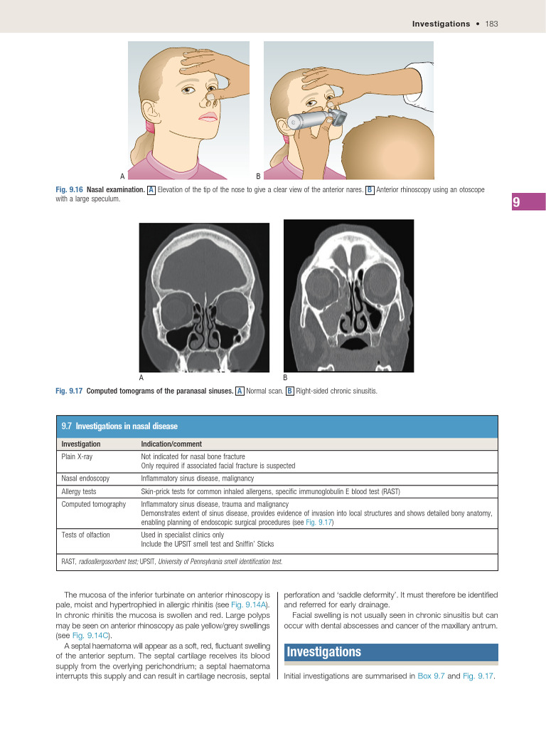 Macleods Clinical Examination 14th Edition Part-5 | PDF | Larynx | Tongue