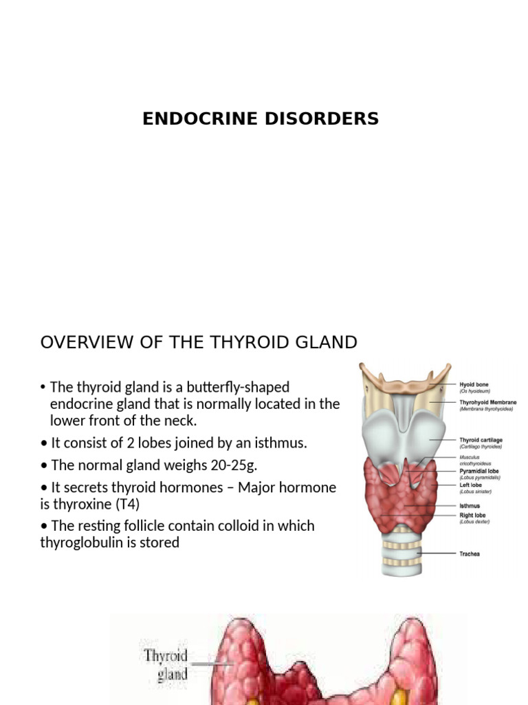 Goitre | PDF | Thyroid | Hyperthyroidism