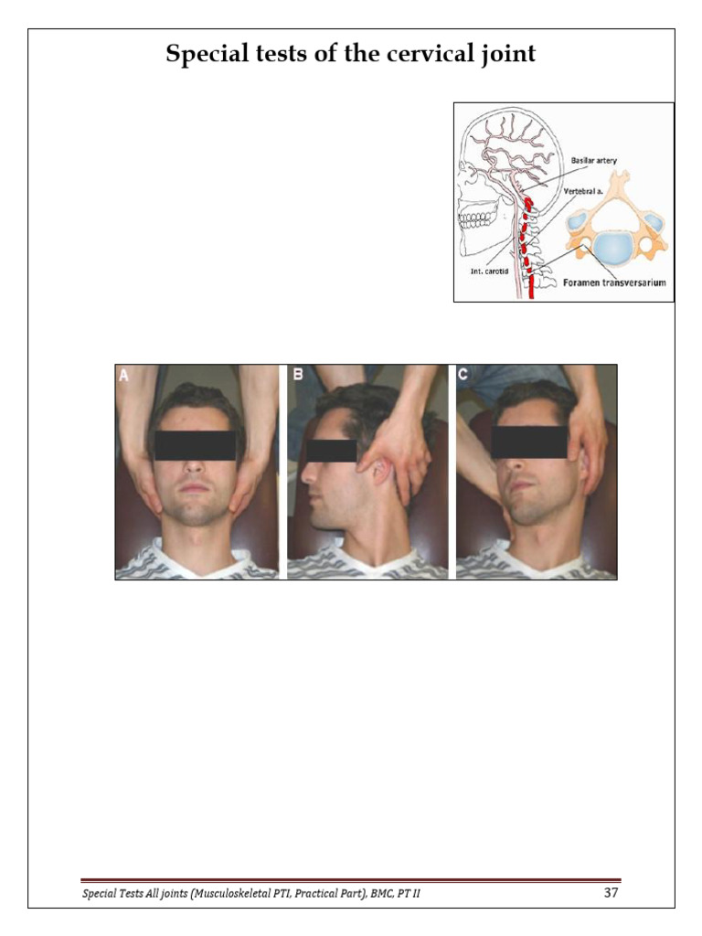 Special Test Cervical Region | PDF | Vertigo | Anatomical Terms Of Motion