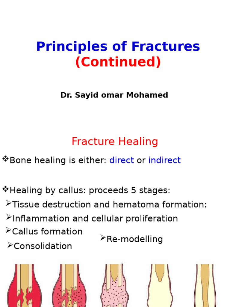 4.1 Principles of fracture | PDF | Diseases And Disorders | Medical ...