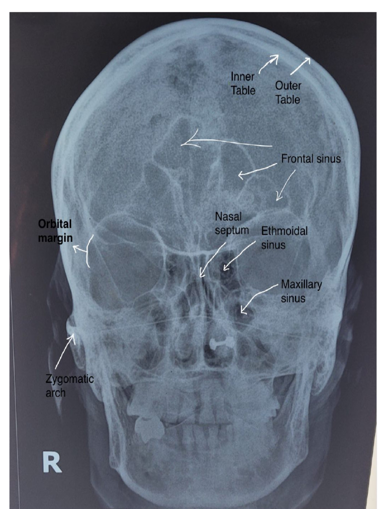 Radiographs BIMS Anatomy | PDF | Gastroenterology