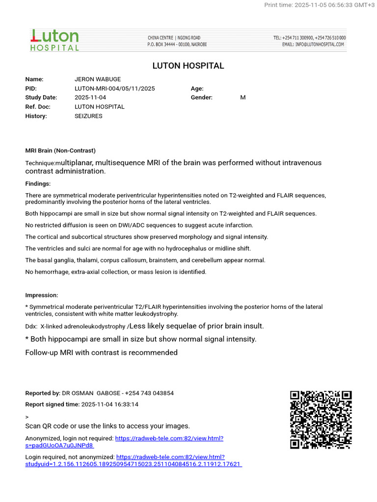 Jeron Wabuge Mr Ot 2025-11-04 | PDF