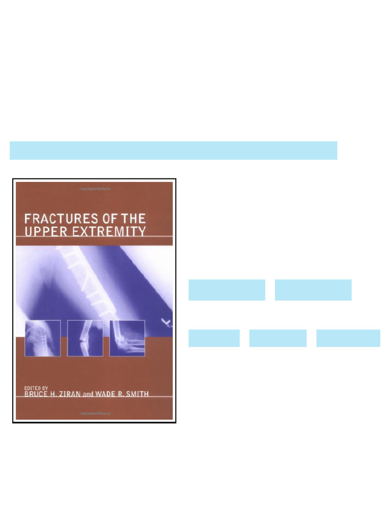 (Ebook) Fractures of the Upper Extremity by by Bruce H. Ziran (Editor ...