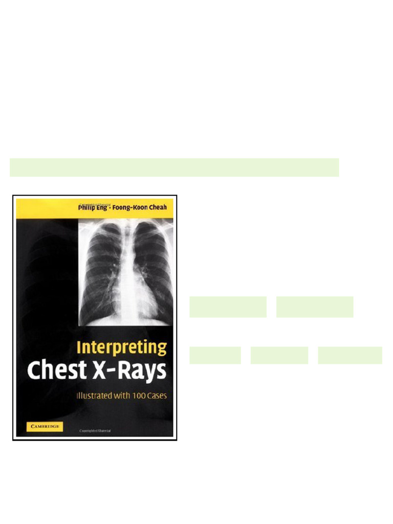 (Ebook) Interpreting Chest X-Rays Illustrated with 100 Cases by Philip ...
