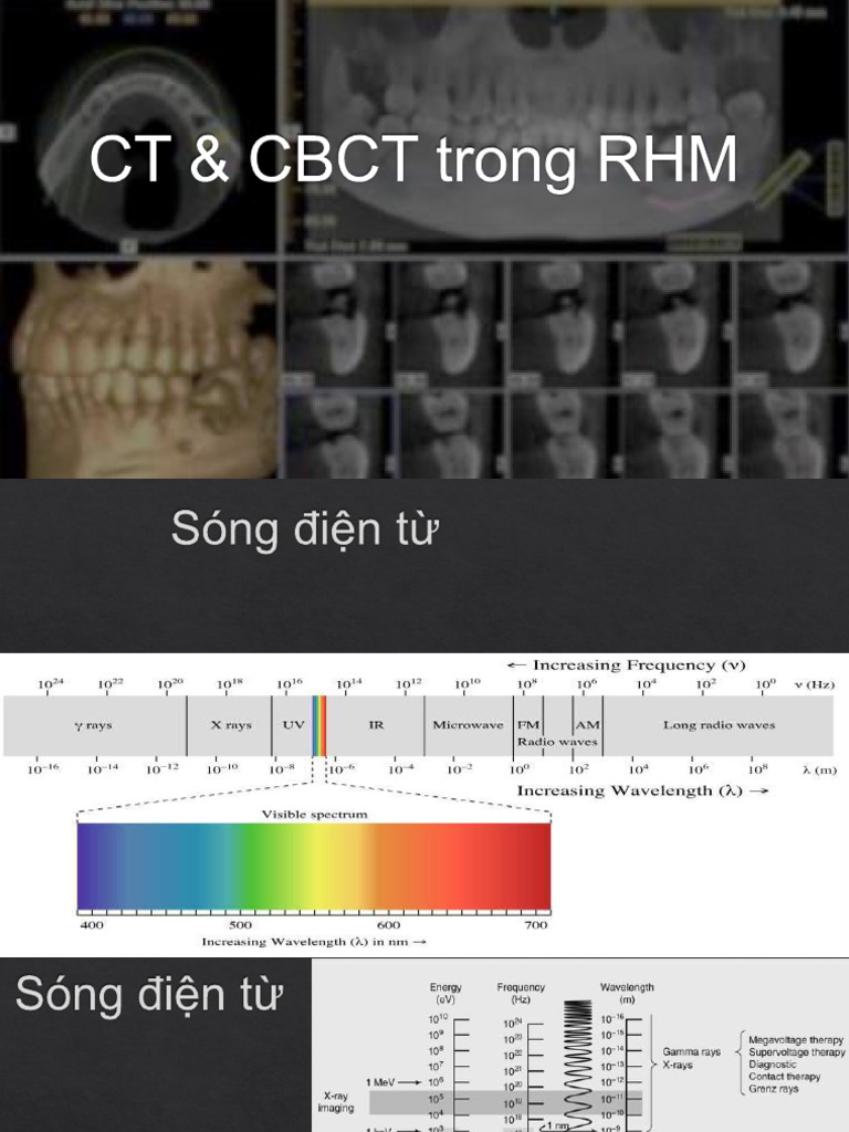 CT CBCT | PDF