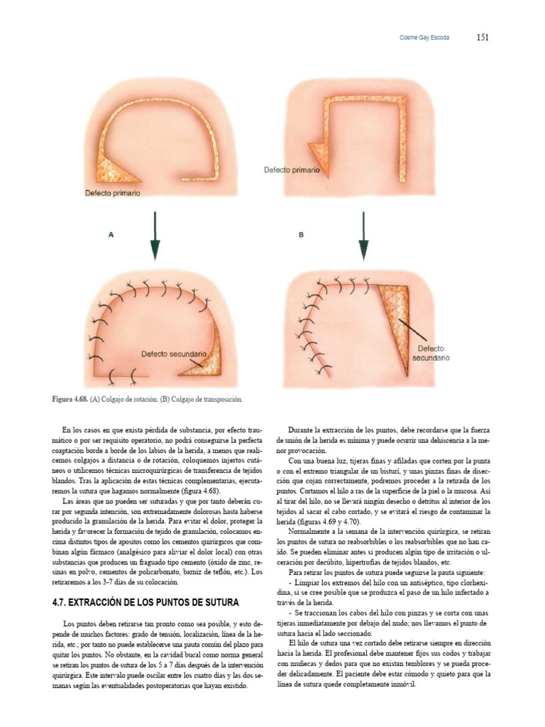 Unidad 5 Cosme Gray | PDF | Anestesia | Benzodiazepinas