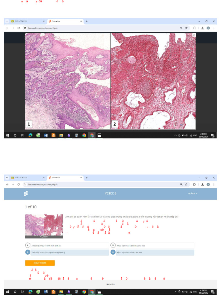 Đề Quá Trình Lần 4 Thứ 6 CA 2 | PDF