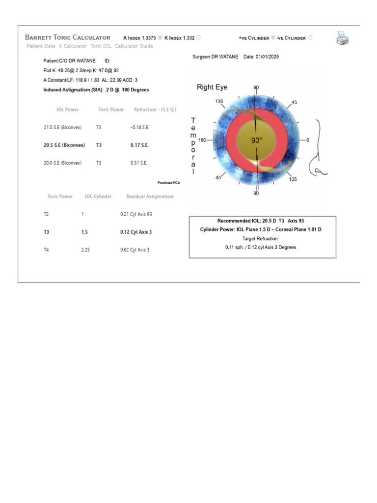 Barrett Toric IOL Calculator Guide | PDF