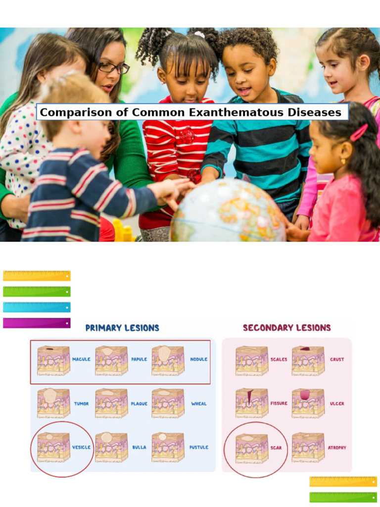 Exanthematous_Diseases_Infographic | PDF | Medicine | Clinical Medicine