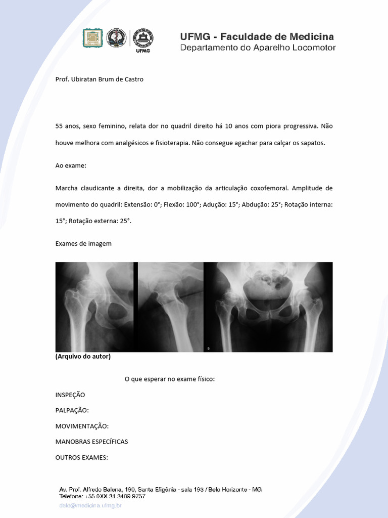 Gd 4- Quadril (Coxoartrose) | PDF