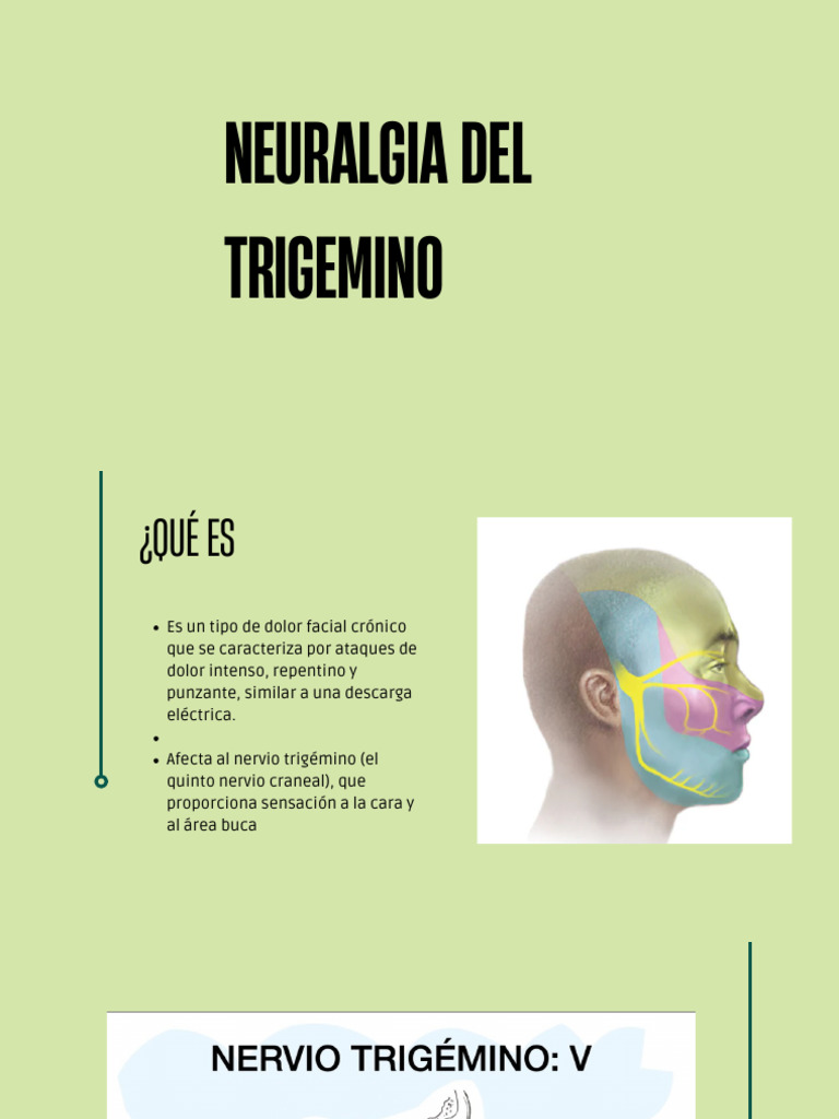 Neuralgia Del Trigemino | PDF | Medicina | Neurología