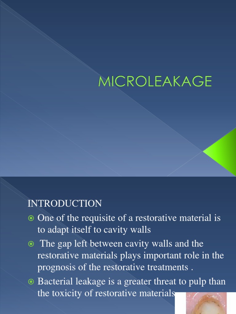 Microleakage Seminar | Dental Composite | Tooth Enamel