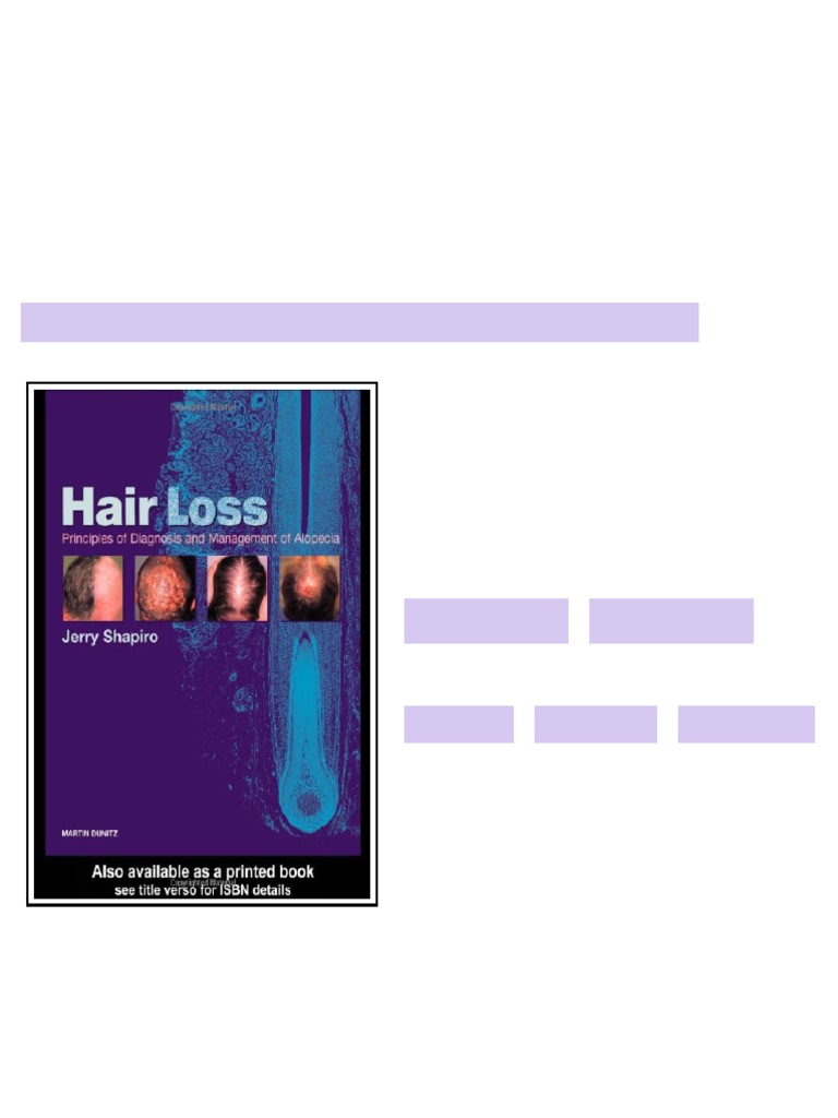 Hair Loss Principles of Diagnosis and Management of Alopecia 1st ...
