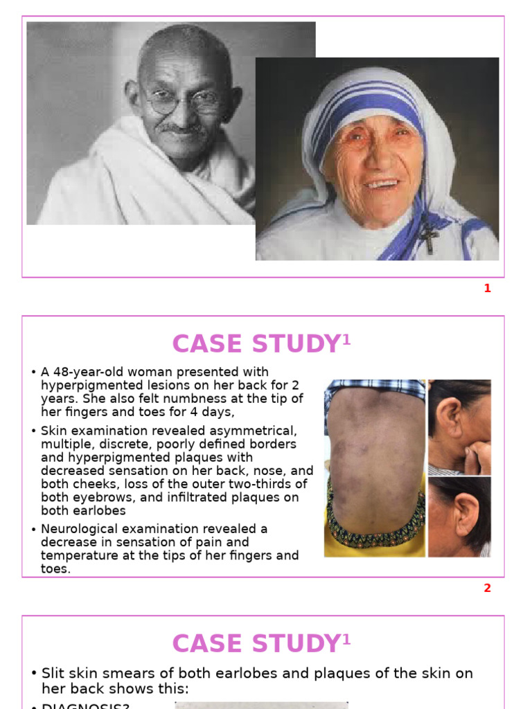 Hansen's Disease Case Study Analysis | PDF