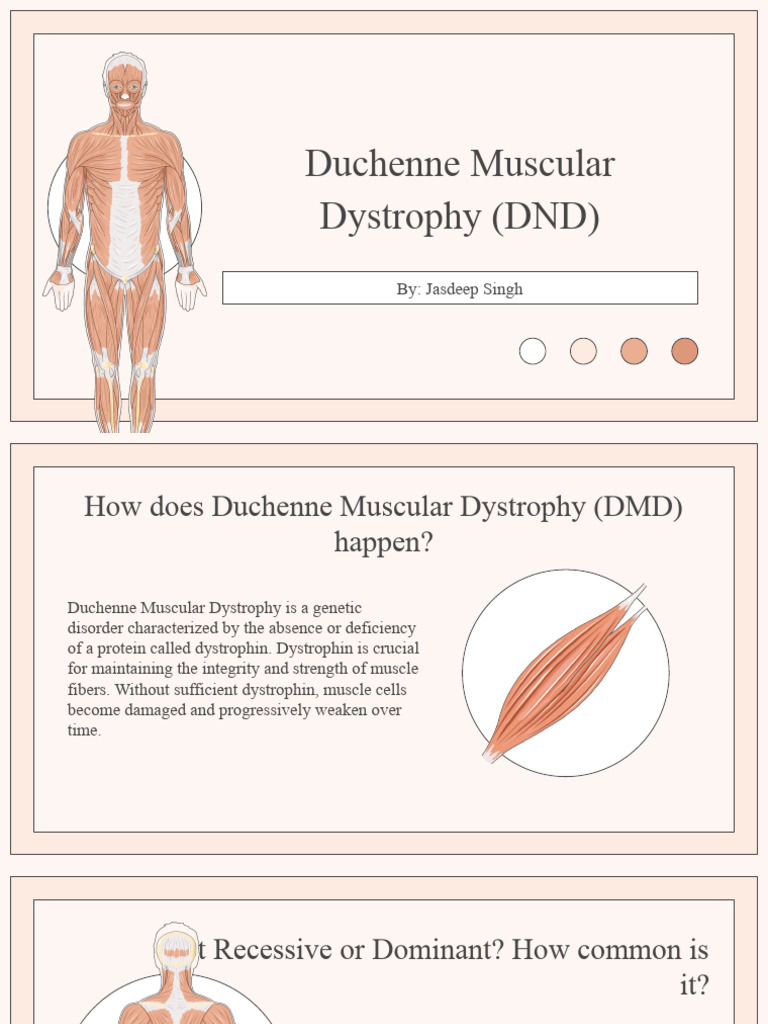688233216 Duchenne Muscular Dystrophy | PDF