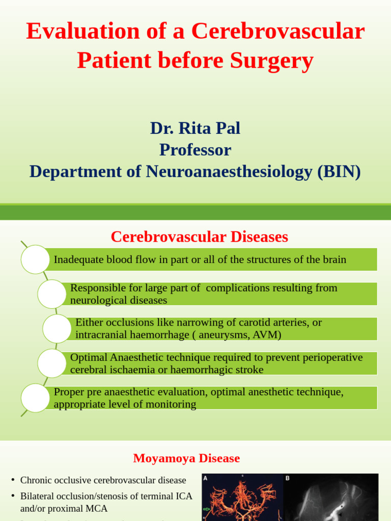 Moyamoya Disease | PDF | Ischemia | Stroke