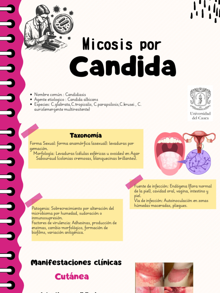 Candidiasis: Tipos, Diagnóstico y Tratamiento | PDF | Candidiasis ...