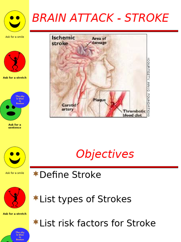 Brain Attack Definition an Did of Stroke Present a It On | PDF | Stroke ...