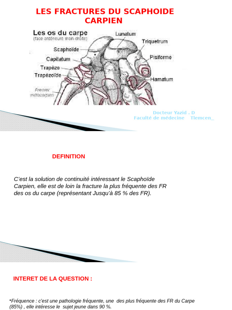 Fractures du Scaphoïde Carpiens : Diagnostic et Traitement | PDF ...