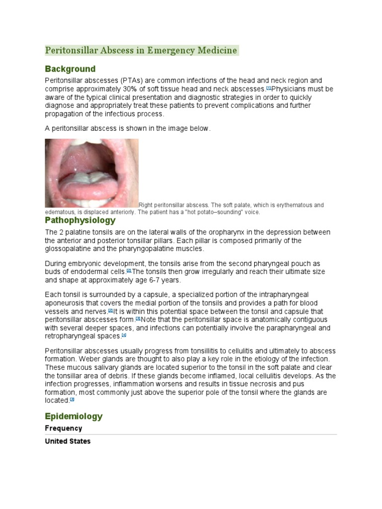 Peritonsillar Abscess Antibiotics Only – Peritonsillar Abscess – NRSAUT