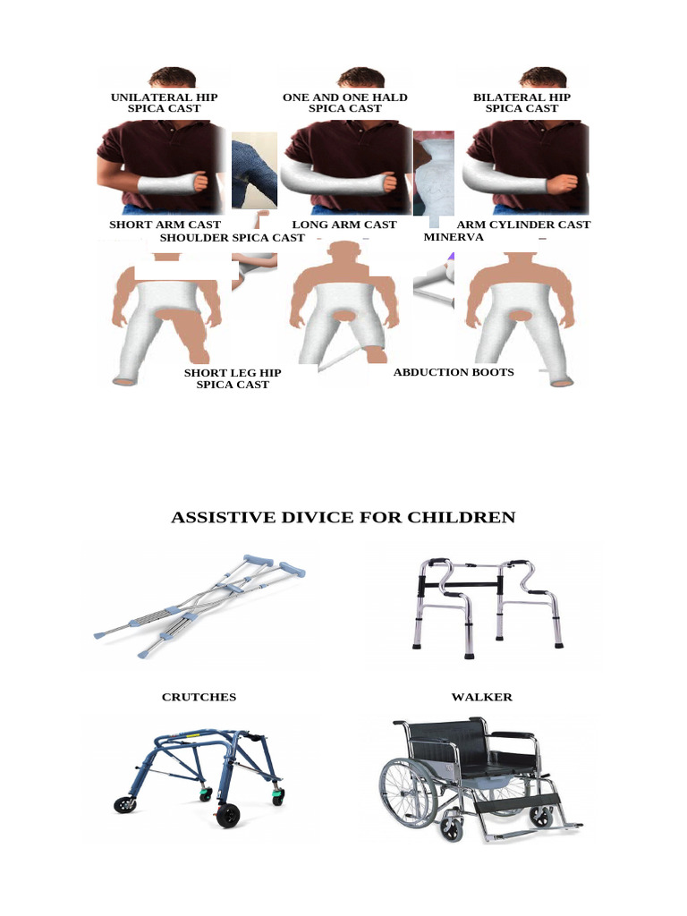 Assistive Devices and Casts for Children | PDF | Musculoskeletal System ...