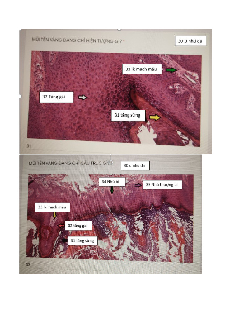 GPB Da | PDF