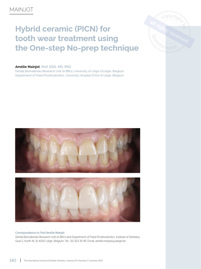 Diagnosis of Tooth Wear - From Erosion To Overload | PDF | Orthodontics ...