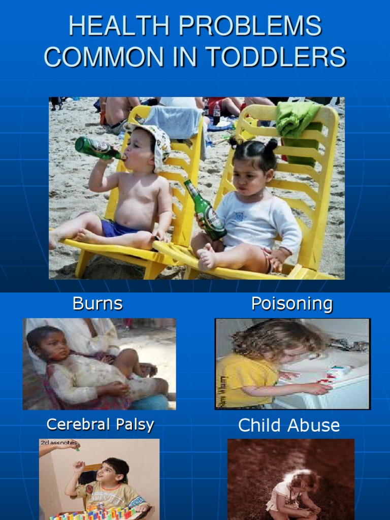 5-Health Problems Common in Toddlers | PDF | Burn | Cerebral Palsy