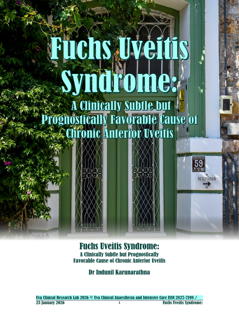 Fuchs Uveitis Syndrome: A Clinically Subtle but Prognostically ...