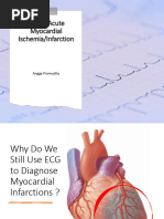 J-Point and STEMI Criteria Explained | PDF | Electrocardiography ...