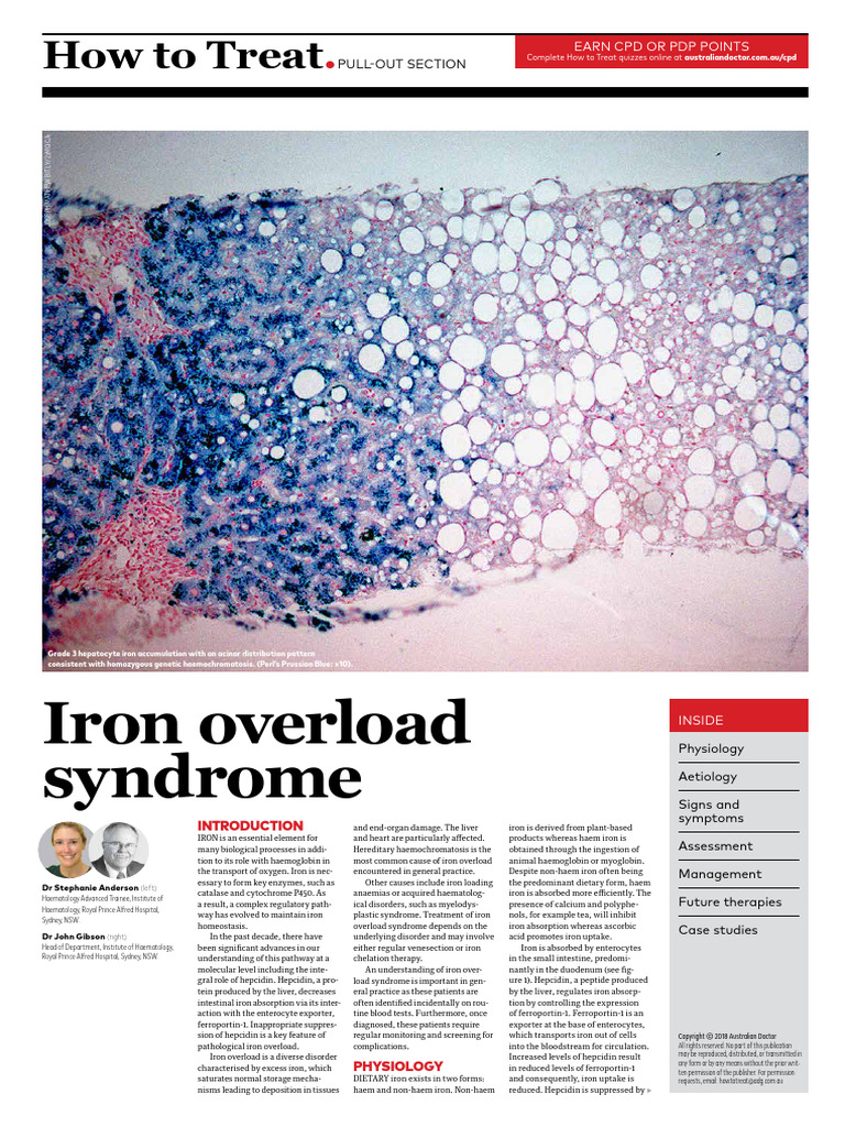 Understanding Iron Overload Syndrome | PDF | Cirrhosis | Anemia