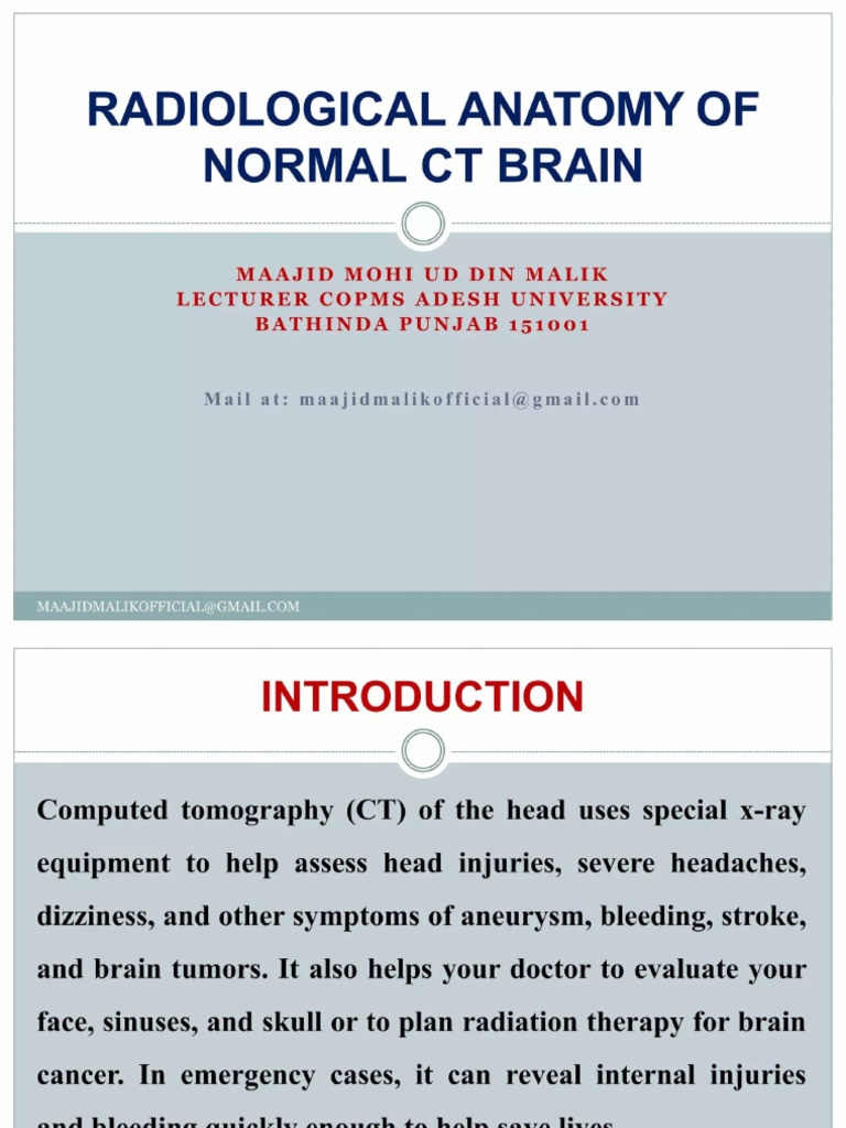Anatomy of Brain for NCCT | PDF