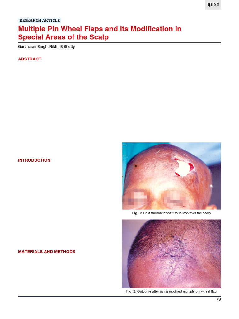 Multiple Pin Wheel Flaps Scalp | PDF | Wound | Human Anatomy