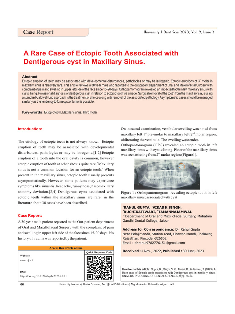 Ectopic Tooth in Maxillary Sinus Case Study | PDF | Tooth | Medical ...